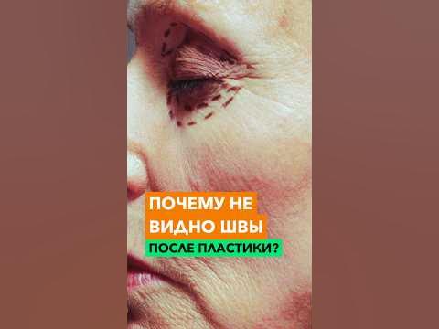 Почему не видно швы после пластических операций? - YouTube