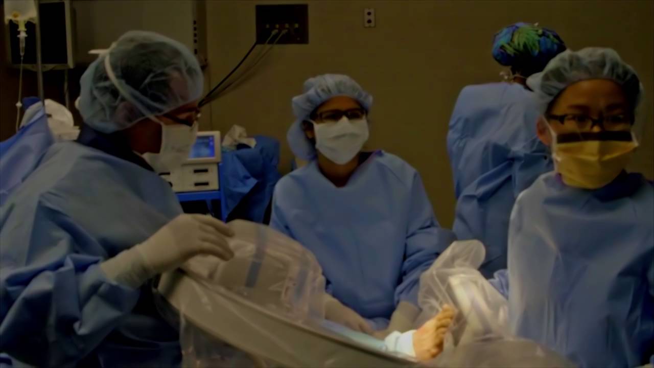 Bunion Surgery via Closing Base Wedge Osteotomy (Dr. Demetrios ...