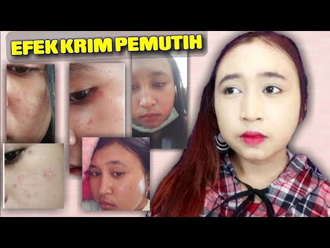 Cara Lepas Dari Krim Dokter & Krim Pemutih Dalam 2 Hari | Putri Yustika ...