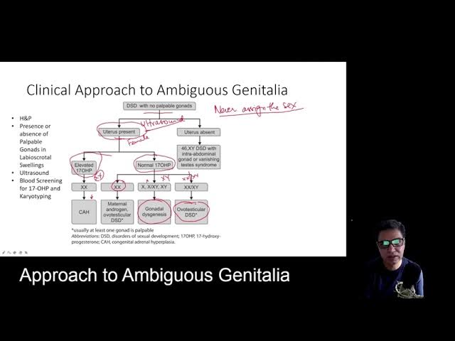 Ambiguous Genitalia Diagram