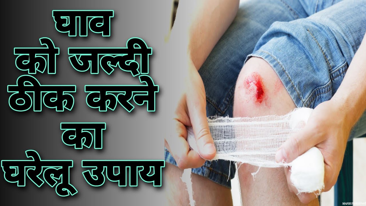 ghav thik karneke ke liye gharelu upay | घाव को जल्दी ठीक करने के उपाय ...
