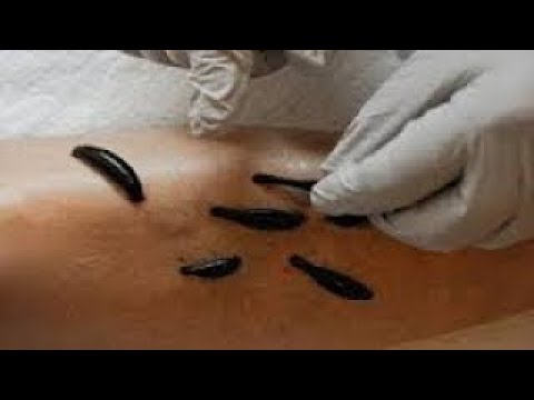 "Leeching" (Zaptie HD Archive) - YouTube