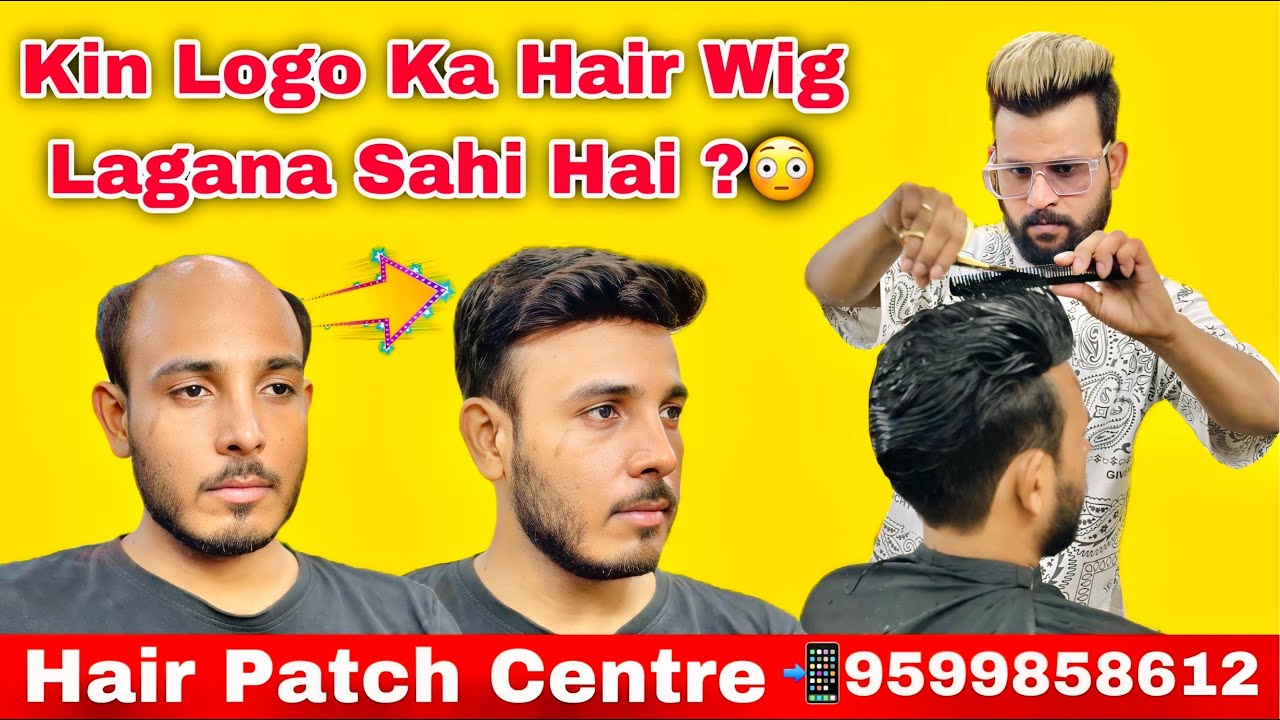 Hair Patch For Men | Hair Patch Work | Hair Transformation With Natural ...
