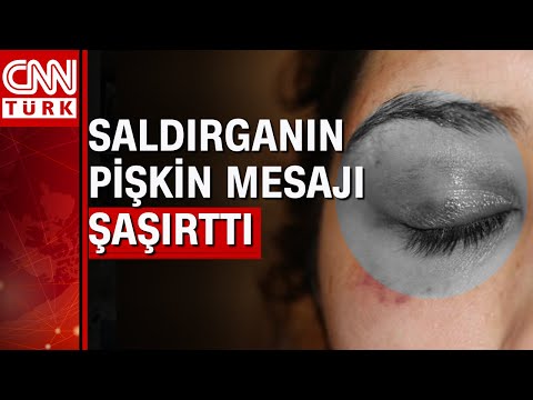 Genç kadını önce dövdü sonra \
