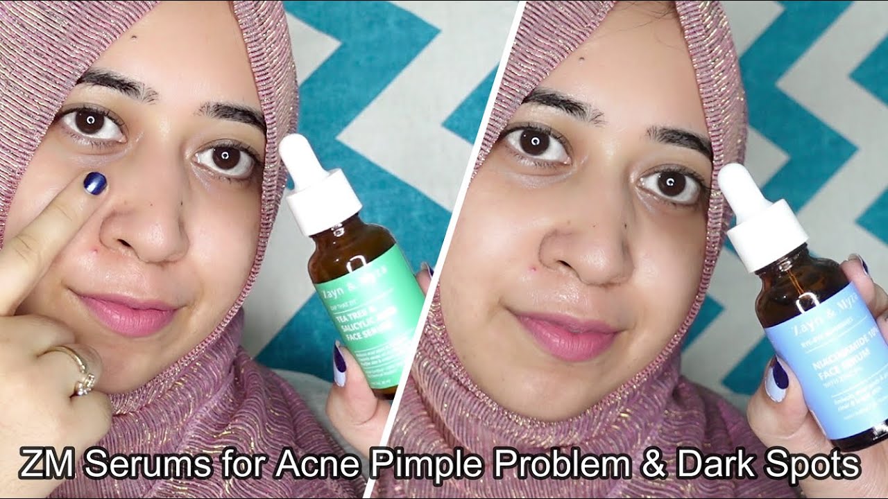 ZM Serums for ACNE, PIMPLE PROBLEM & DARK SPOTS Solution | Skincare ...