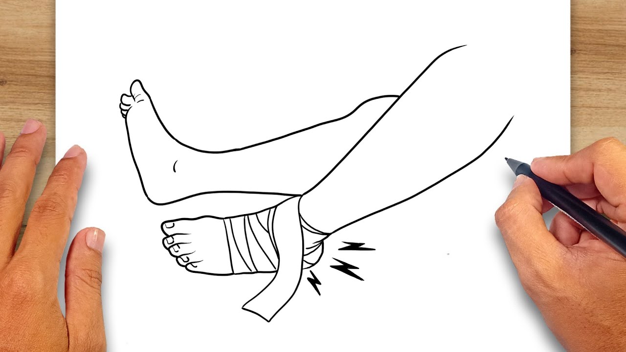 How to draw Injured Foot - YouTube