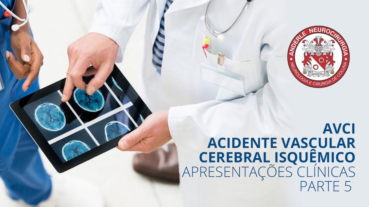 AVCI ACIDENTE VASCULAR CEREBRAL ISQUÊMICO - APRESENTAÇÕES CLÍNICAS ...