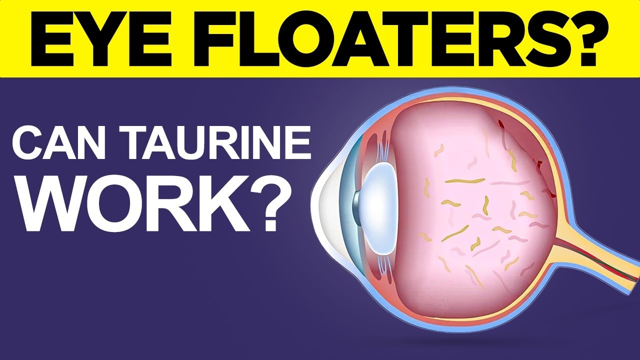 SHOCKING Truth About Taurine for Eye Floaters! - YouTube