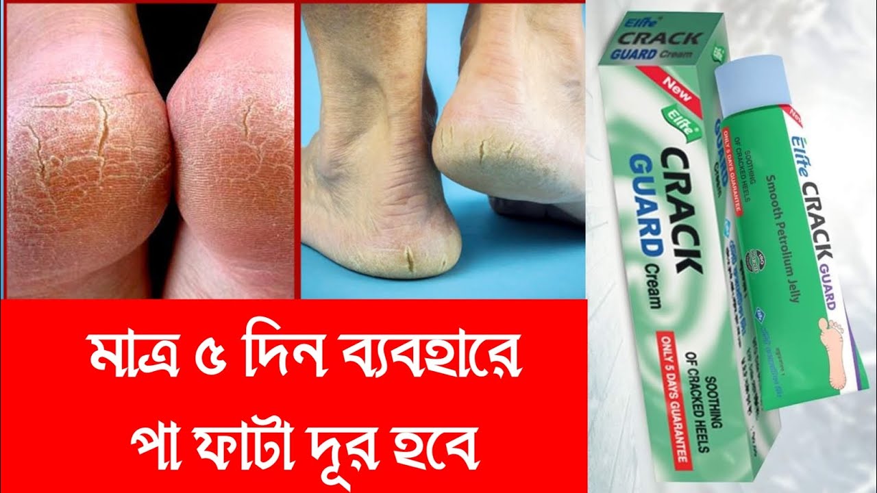 Elite Crack Guard ( এলিট ক্র্যাক গার্ড ) এর কাজ | Heel Repair Cream ...