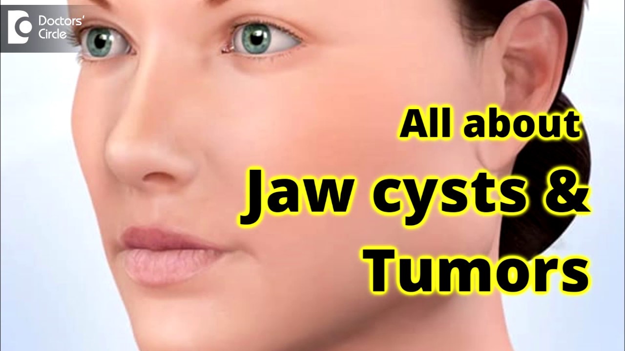 Lump Under Chin lump-under-chin