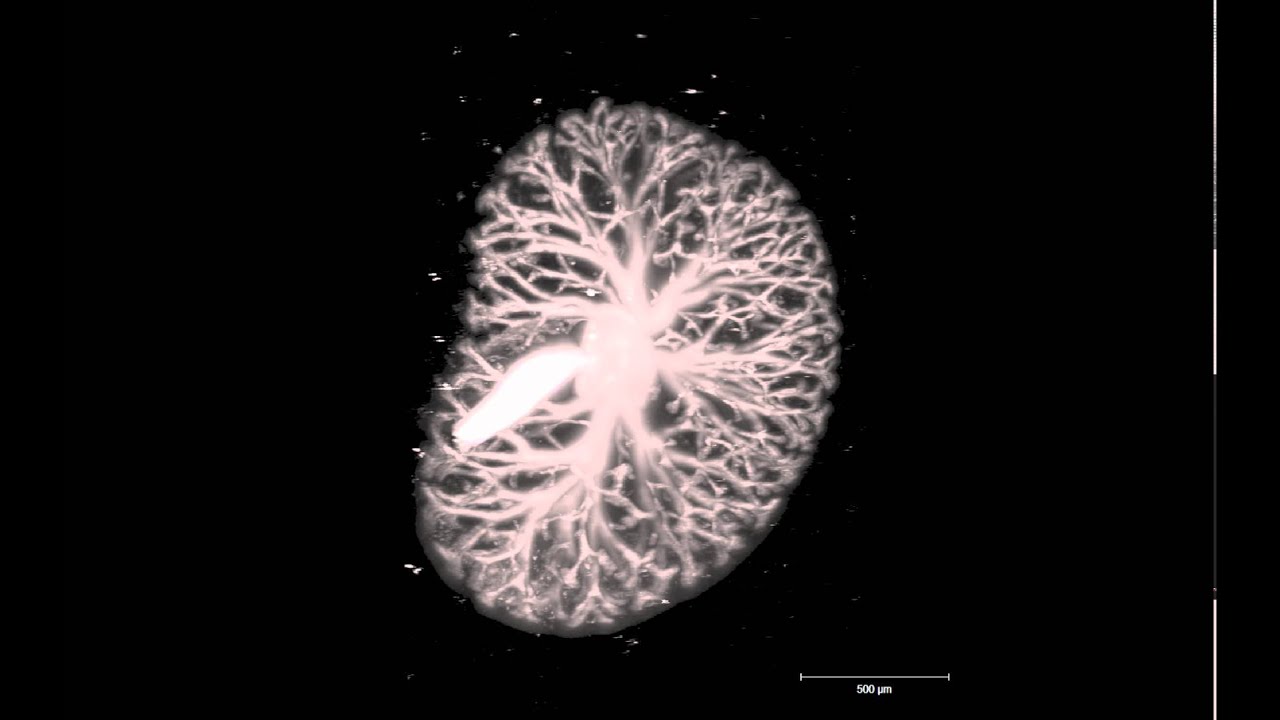 Itty Bitty Mouse Kidney - YouTube