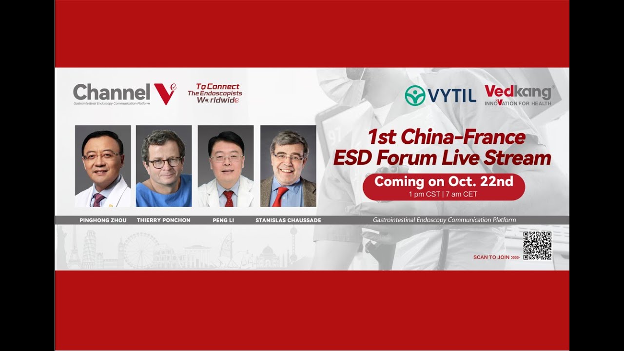 1st China France ESD Forum Live Stream - YouTube