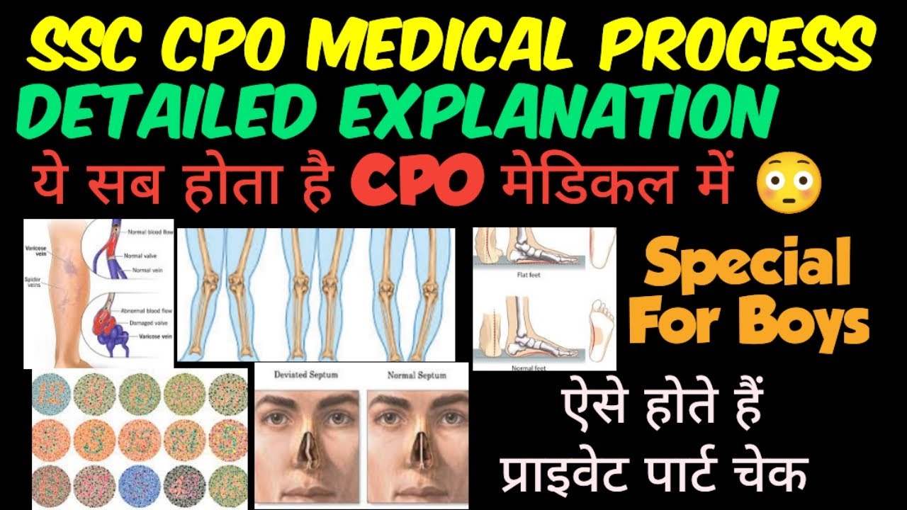 SSC CPO Complete Medical Process प्राइवेट पार्ट कैसे चैक होते हैं सभी ...