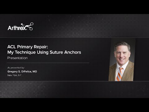 ACL Primary Repair: My Technique Using Suture Anchors - YouTube