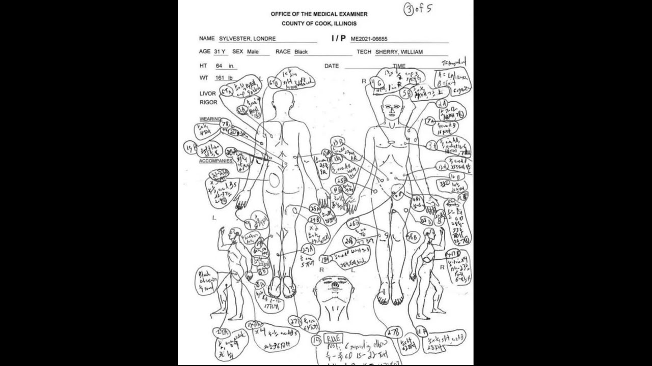 😱LEAKED SCANNER AUDIO - KTS DRE HOMICIDE SCANNER AUDIO 😱 - YouTube