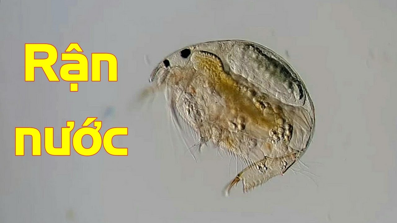 28 Rận nước dưới kính hiển vi - Pleuroxus under microscope | # ...