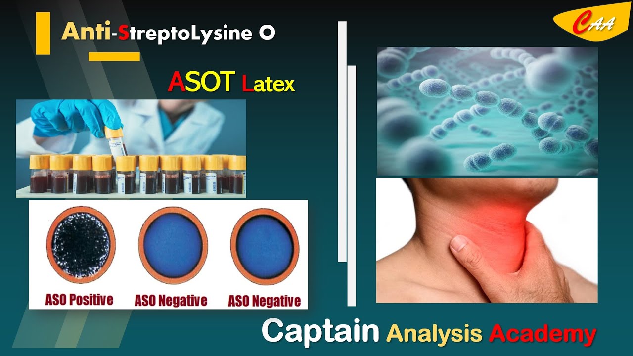 تحليل الميكروب السبحى عملى ASOT Test - YouTube