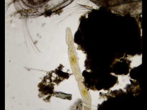 Pond water under microscope - segmented worm - YouTube