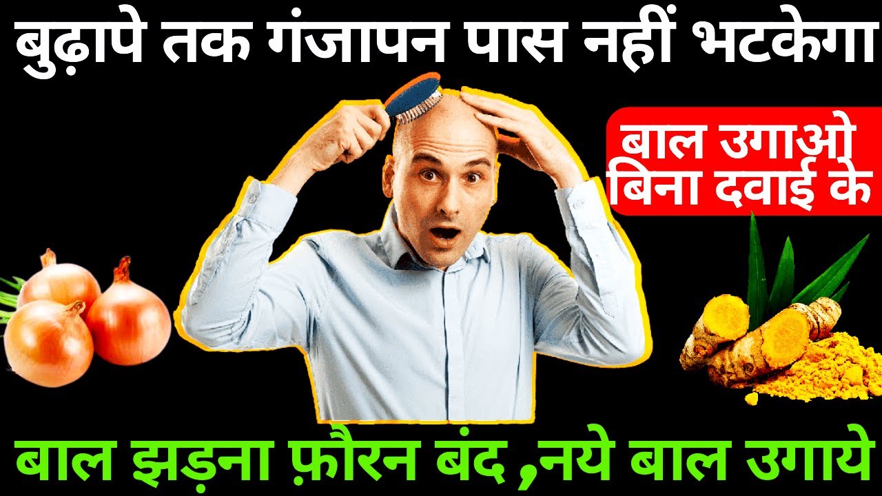 How Can I Reduce DHT Naturally? | Foods That Block DHT and Fight Hair ...