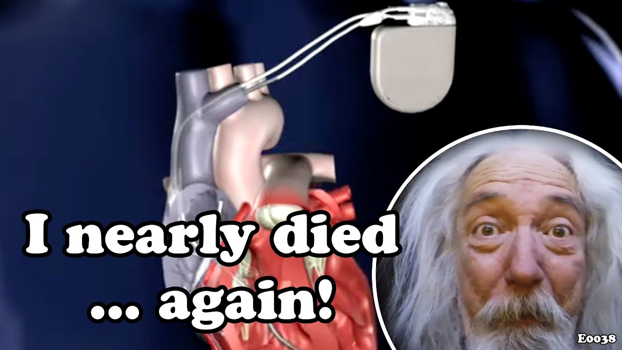 #38 - Getting an ICD the hard way: Implantable Cardioverter ...