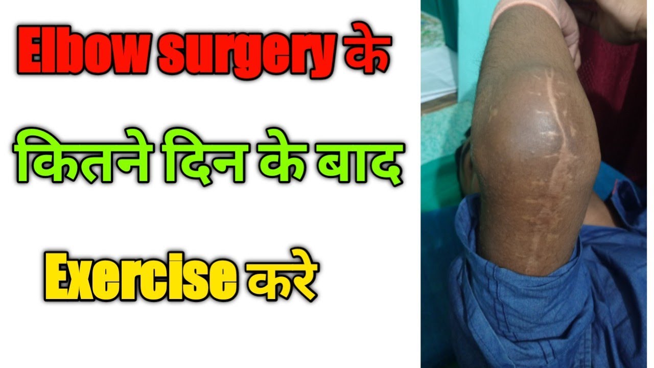 Elbow stiffness exercises surgery ke bad Physiotherapy kab se start ...