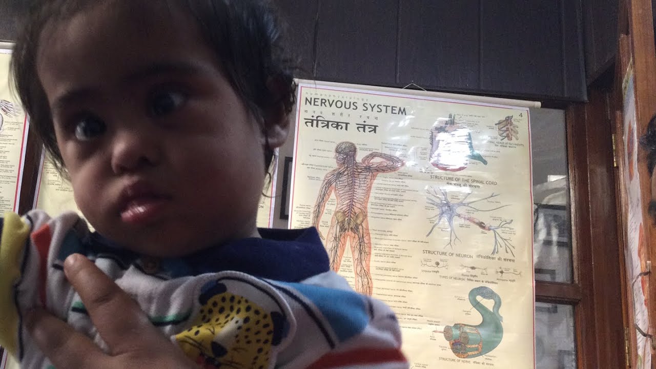 Down syndrome & infantile spasm - changes in 2 hrs with balance and ...