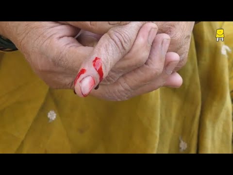 Minor cuts (Marathi) | किरकोळ कापणे