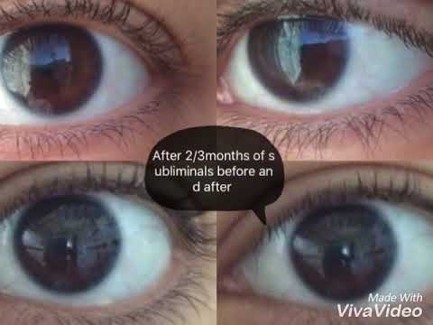 Before and after biokinesis eye color change - YouTube