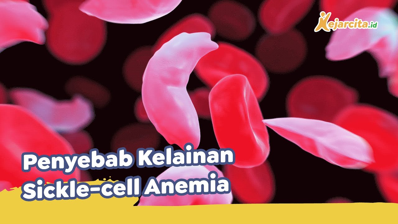 Penyebab Kelainan Sickle-cell Anemia | Contoh Soal Materi Mutasi ...