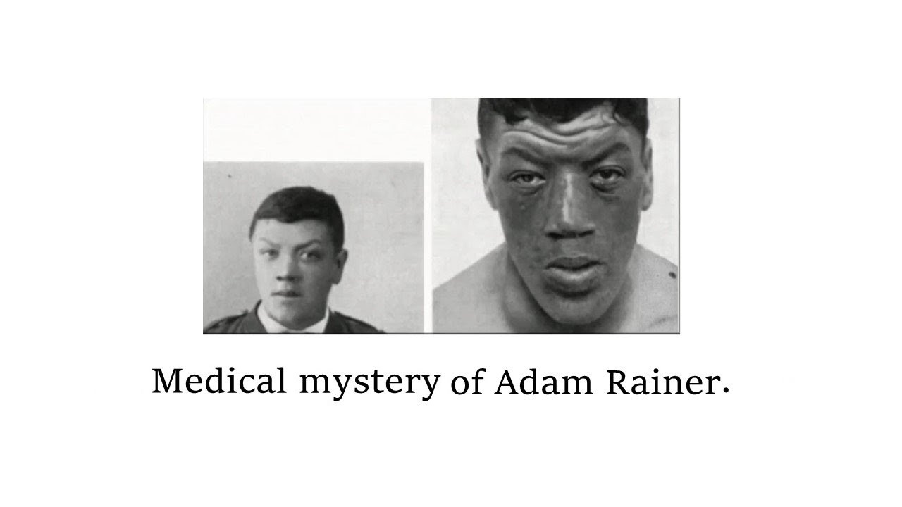 AMAZING !!!! BOTH DWARF & GIANT ??!!!!?? ADAM RAINER - YouTube