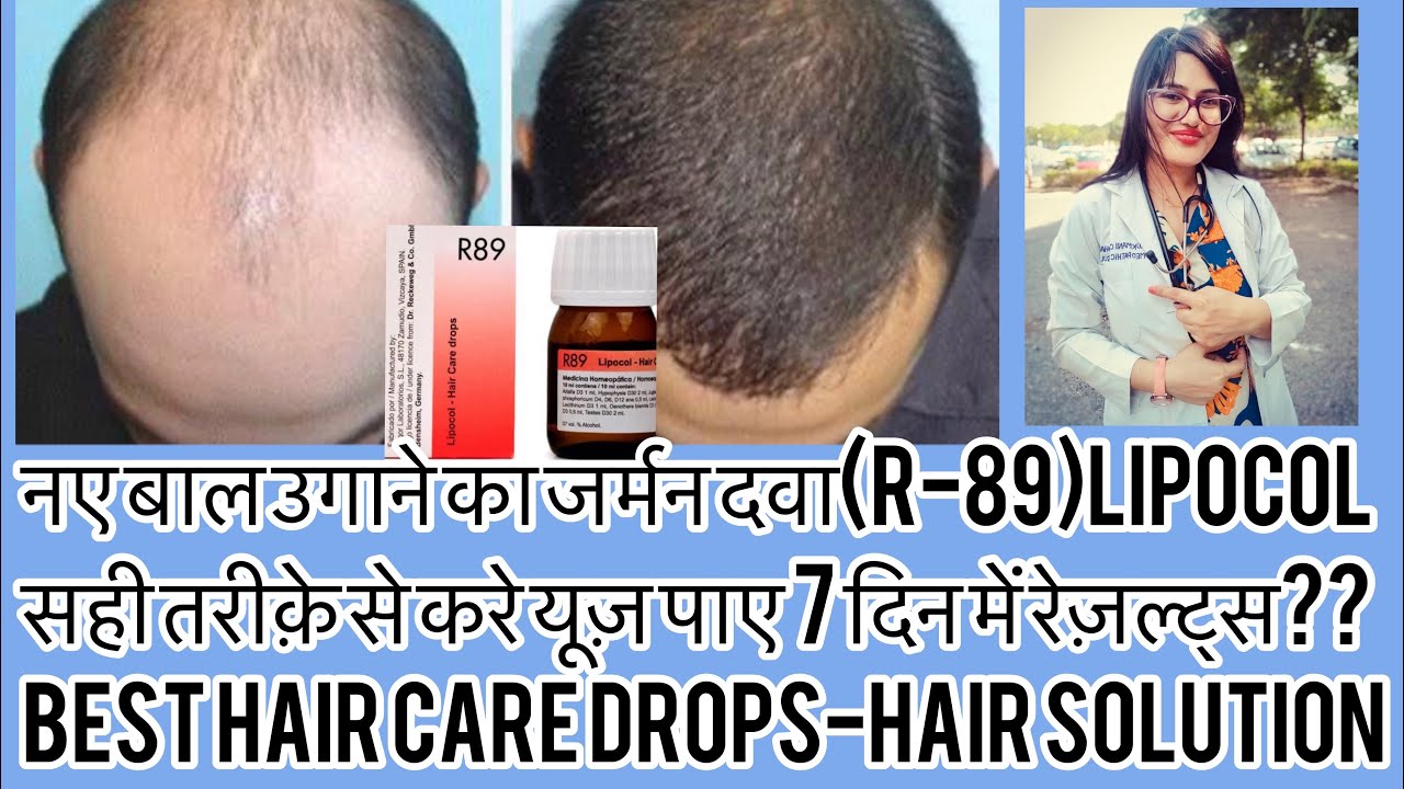 Lipocol R89german medicine | नएबाल उगाने का आसान तरीक़ा ?R89medicine ...