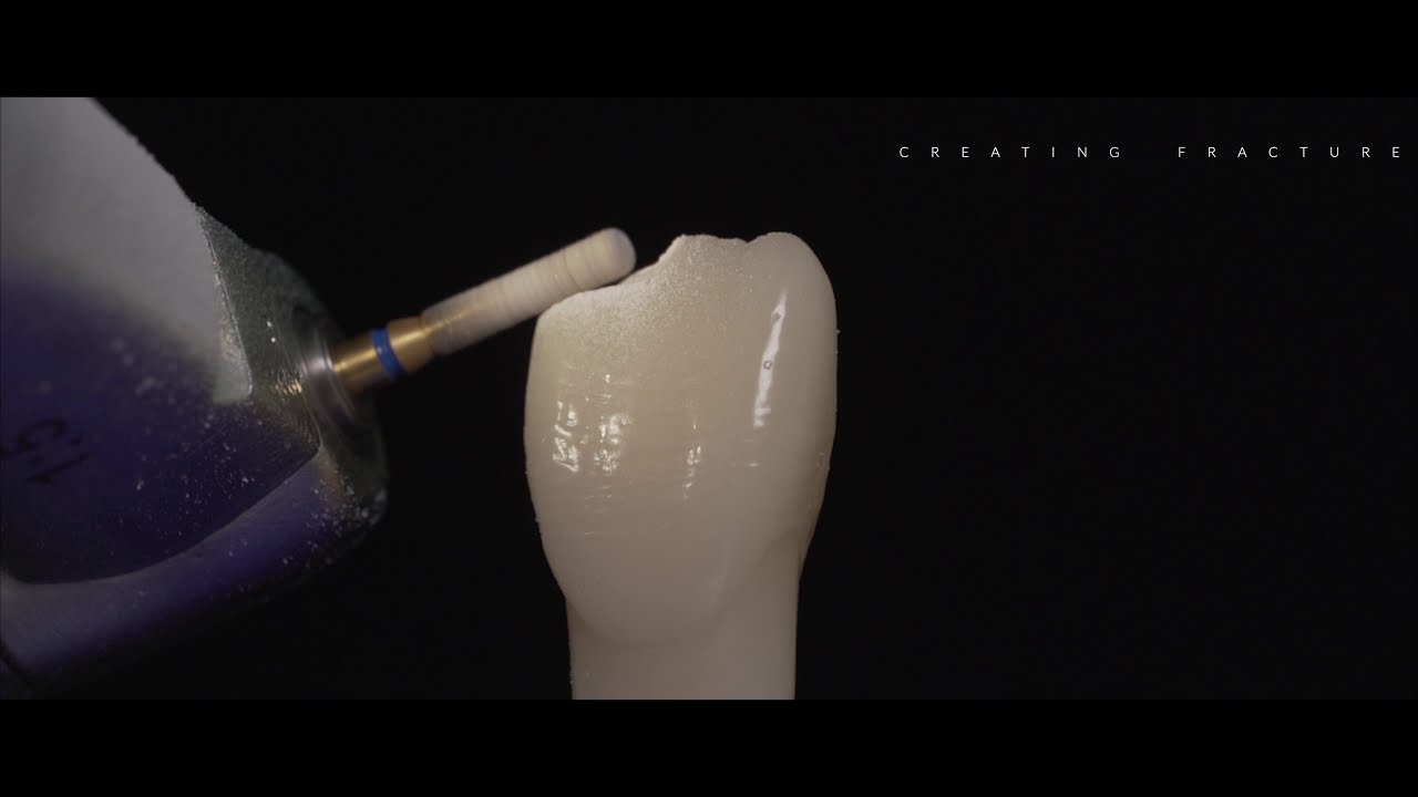 Simple Class IV Anterior Composite Restoration Presented by Dr. Rhodri ...