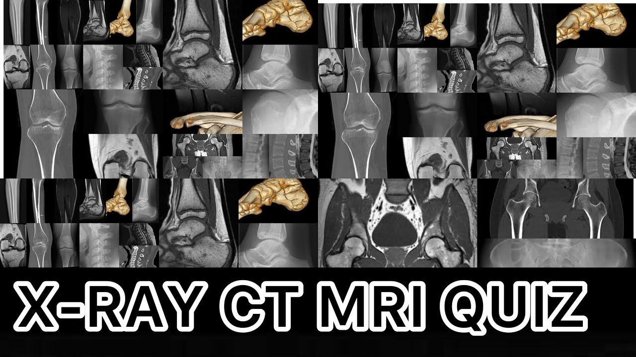 X-RAY CT MRI QUIZ…Find out from which modalities these images are ...