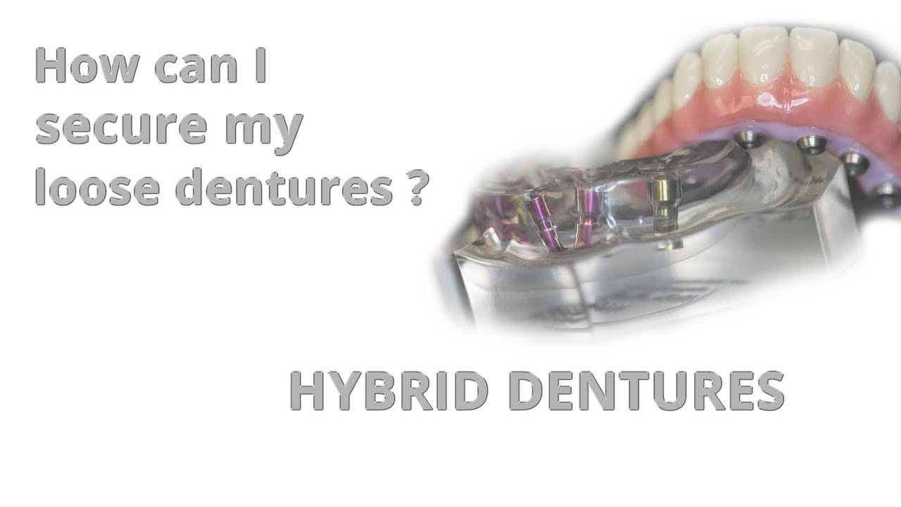 Dr. Bork shares how hybrid implant supported dentures can stabilize ...
