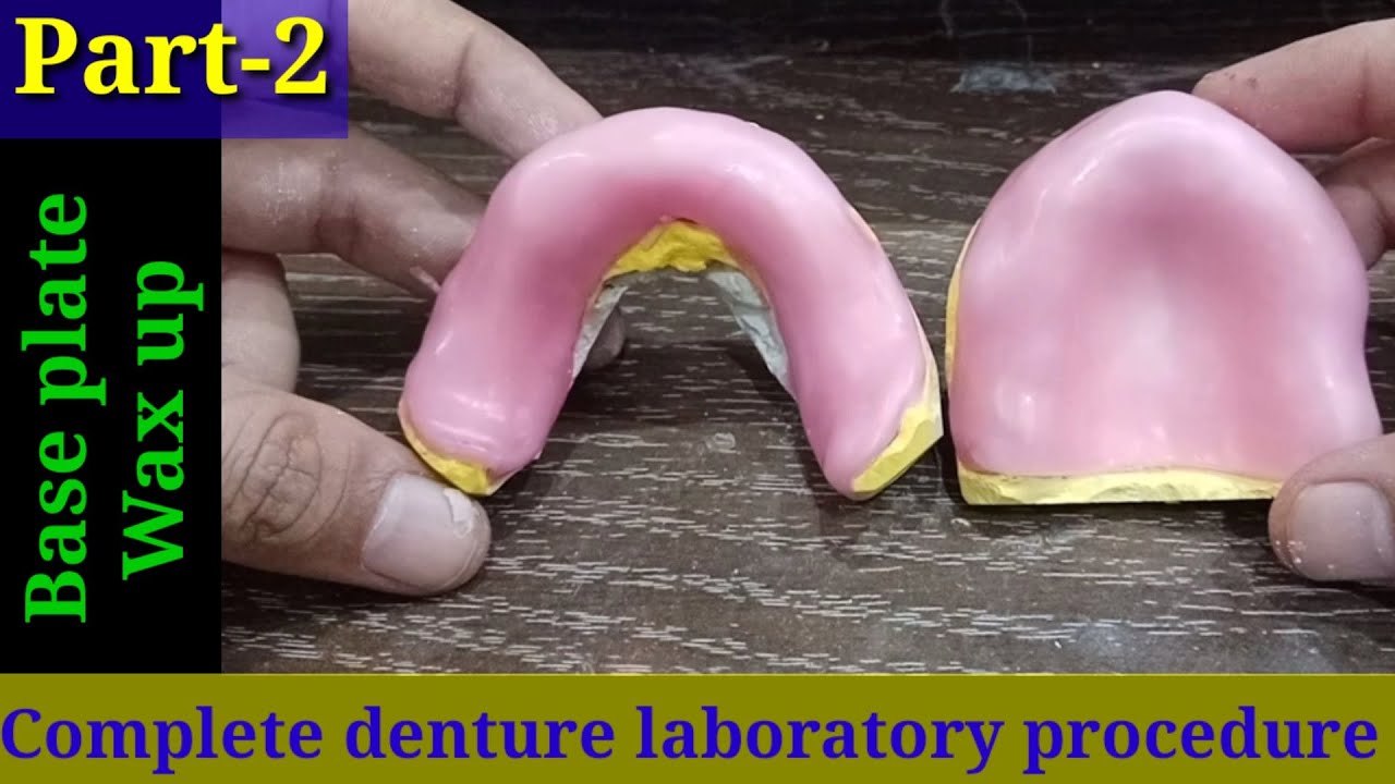 Complete Dentur laboratory procedure part-2 || WAXING baseplate ...