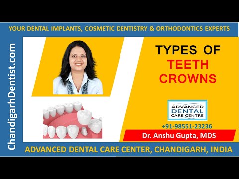 TYPES OF TEETH CROWNS/CAPS CHANDIGARH  |  COST OF DENTAL CROWNS CHANDIGARH | COST OF TEETH CAPS