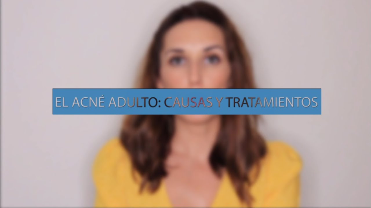 El acné adulto: causas y tratamientos - YouTube