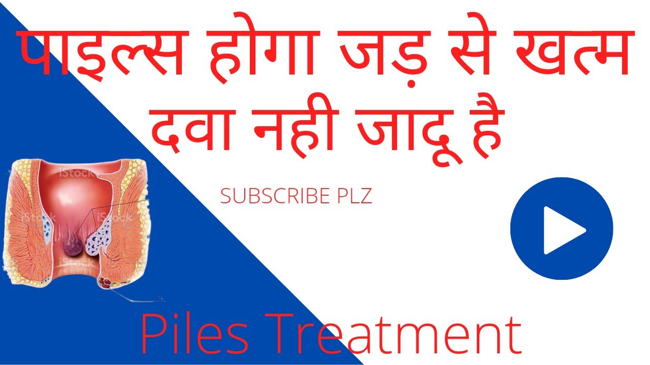 How to treat piles with homeopathic medicine piles treatment - YouTube
