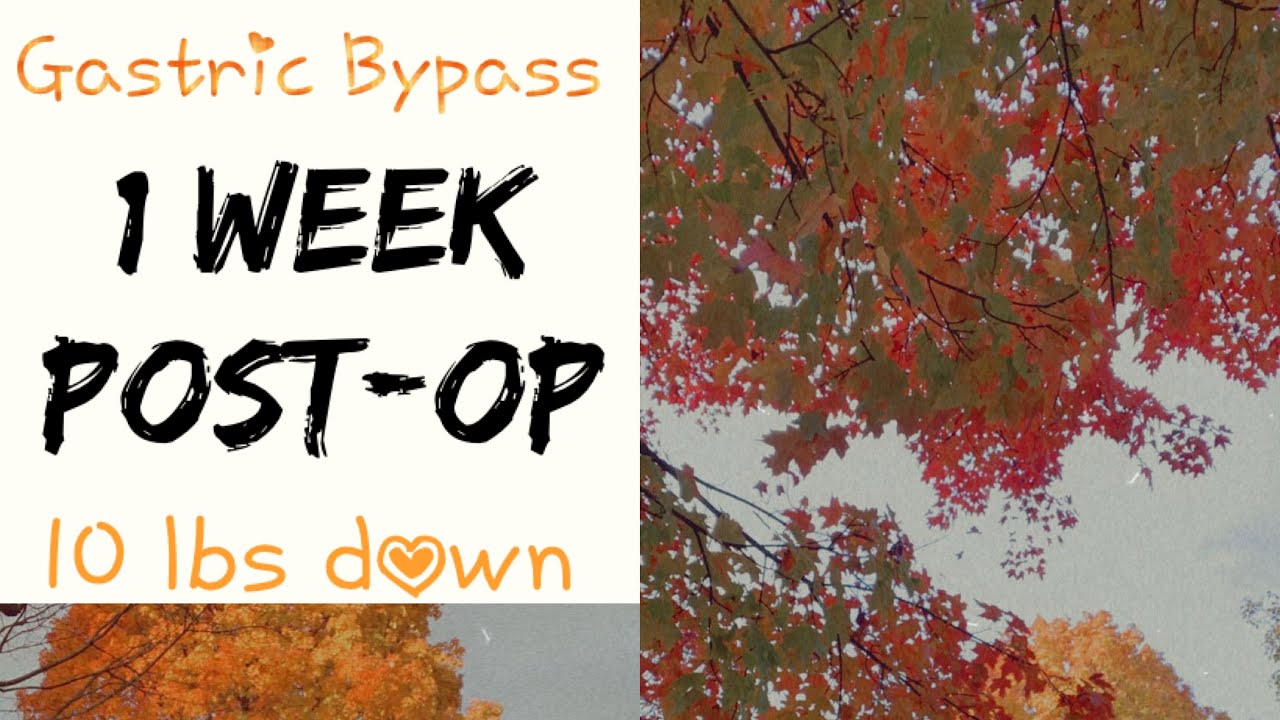 POST OP WEEK 1 // 10 LBS DOWN || GASTRIC BYPASS - YouTube