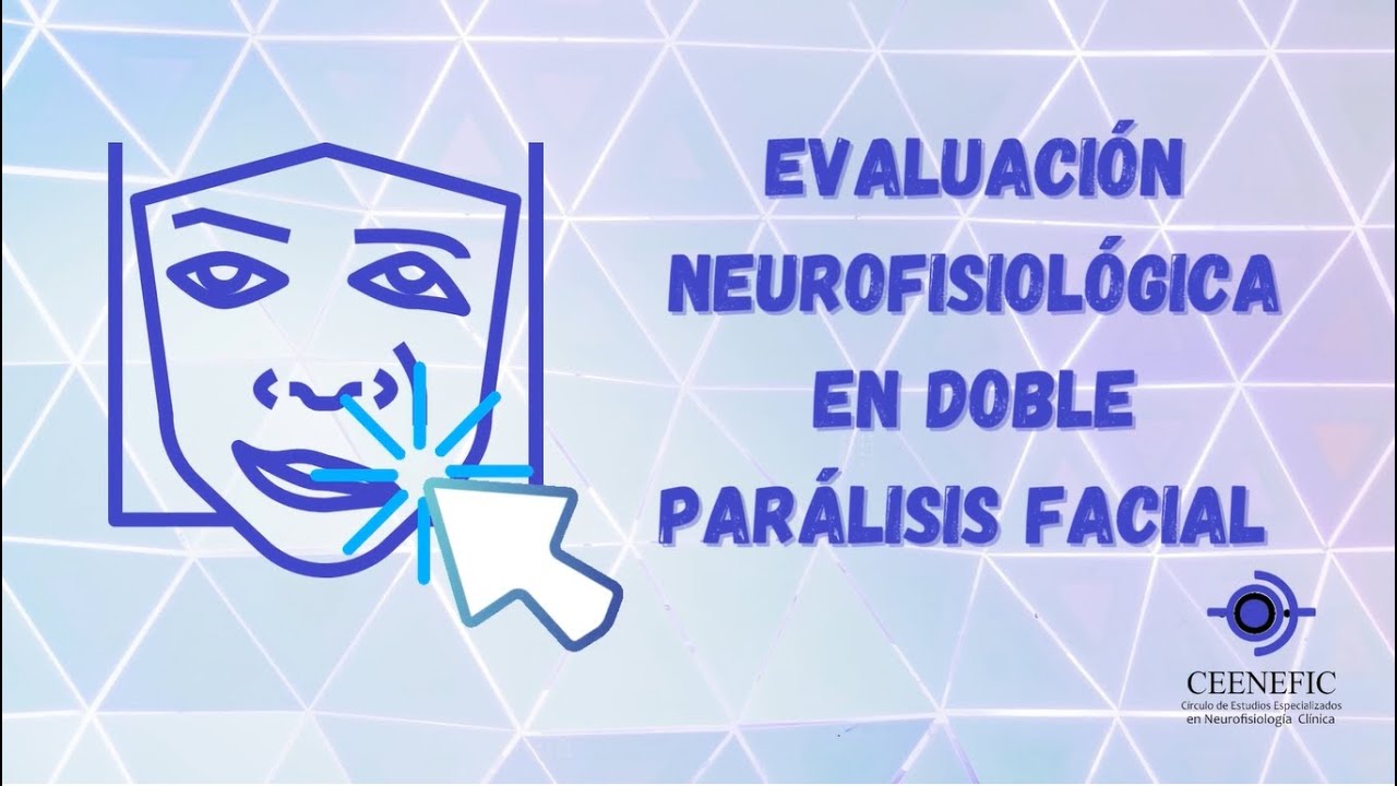 ELECTROMIOGRAFÍA EN PARÁLISIS FACIAL BILATERAL - YouTube