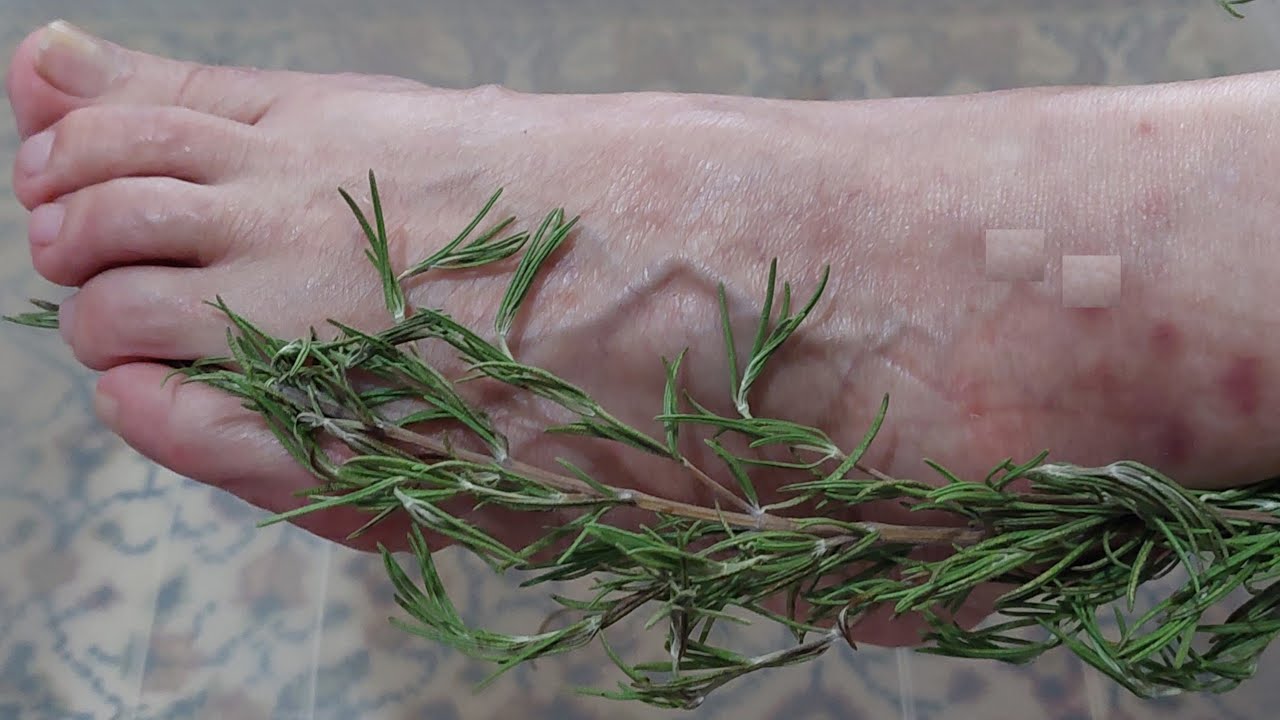 Bacak Ağrısı, kramplar topuk dikeni romatizma! Annem AĞRI ve varisli ...