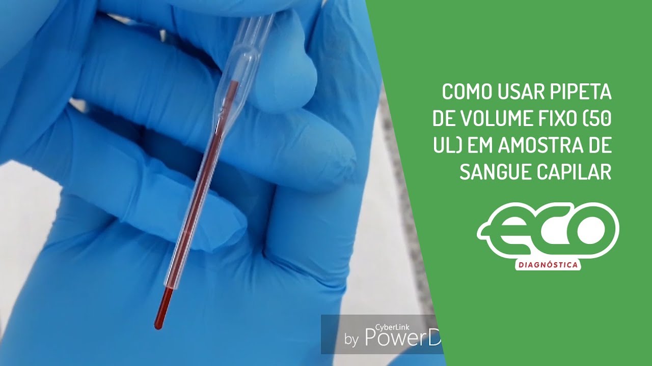 Como usar pipeta de volume fixo (50 uL) em amostra de sangue capilar ...