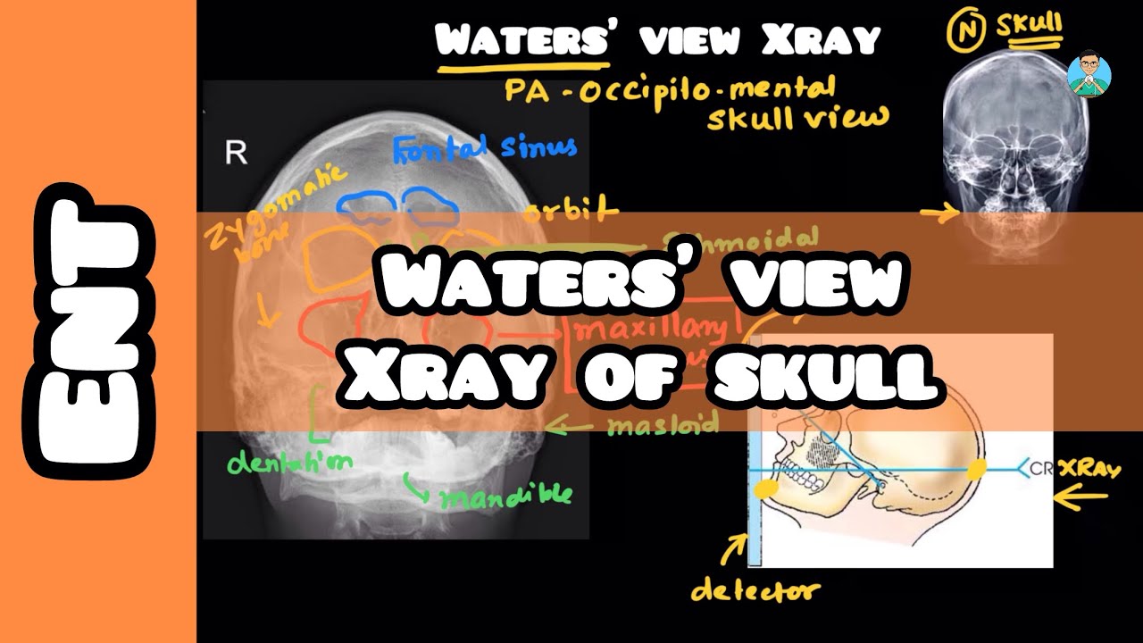 Waters’ view of Skull: #usmle #firstaid for #inicet #neetpg #nclex ...