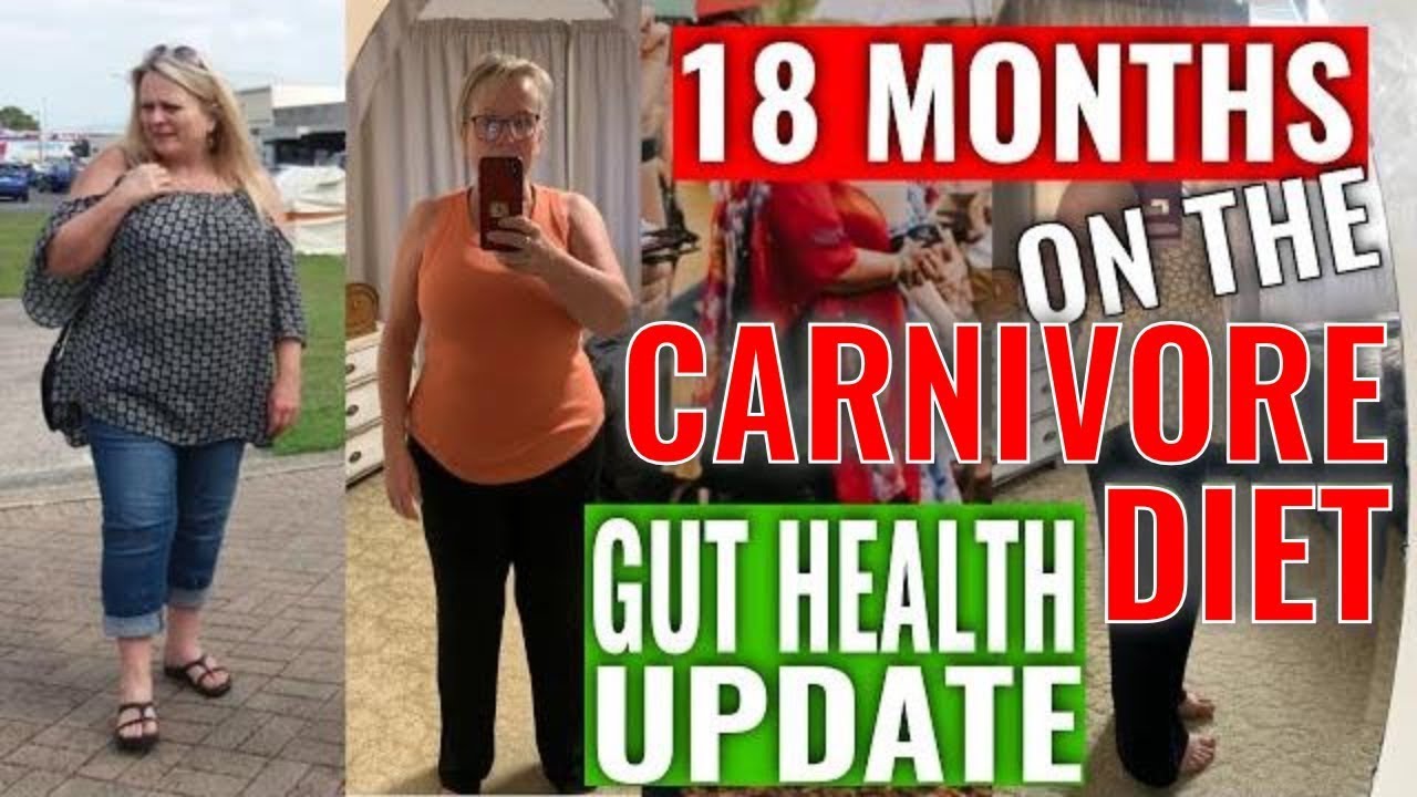 18 Months on Carnivore Diet Update - Healing SIBO Naturally, IBS ...
