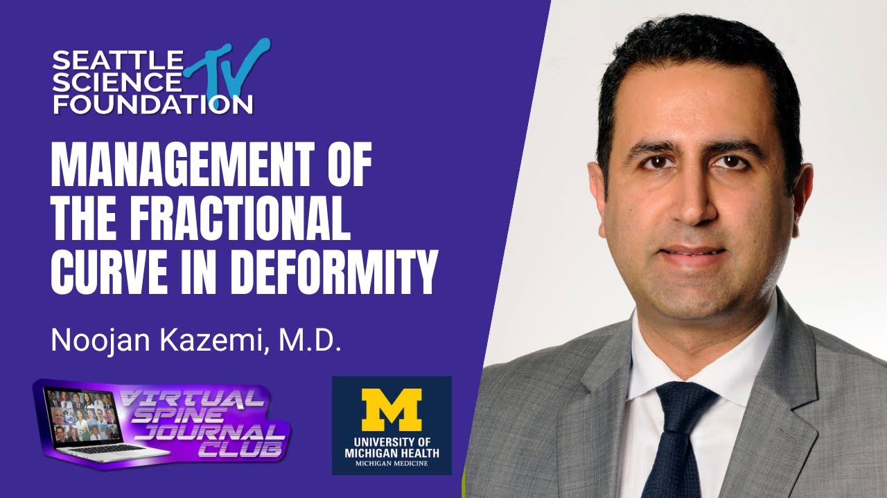 Management of the Fractional Curve in Lumbar Deformity – Noojan Kazemi ...