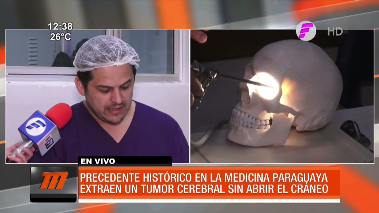 Extraen tumor cerebral sin abrir el cráneo en IPS - YouTube