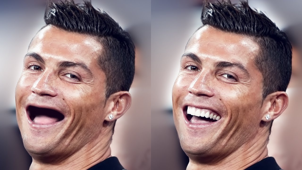 Et si les joueurs de football n'avaient pas de dents Comment ils vont ...