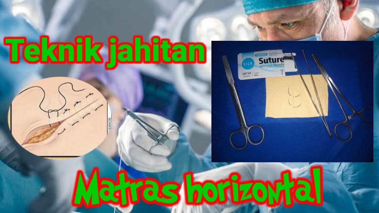 Teknik jahitan Matras Horizontal - YouTube