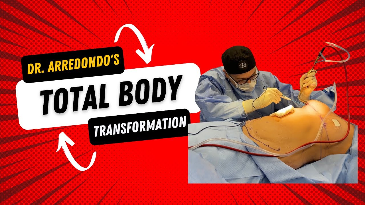 Dr. Arredondo's Total Body Transformation - YouTube