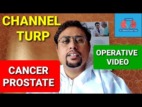Channel TURP | Transurethral Resection of the Prostate (TURP)\Prostate ...